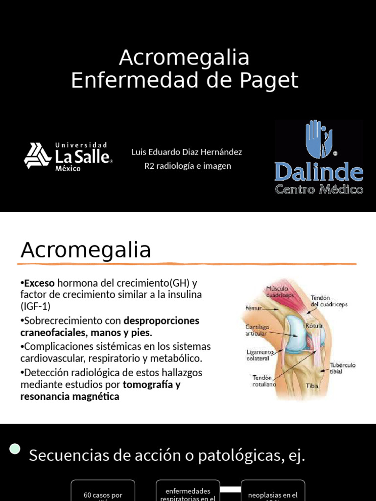 Acromegalia | PDF | Hueso | Patología