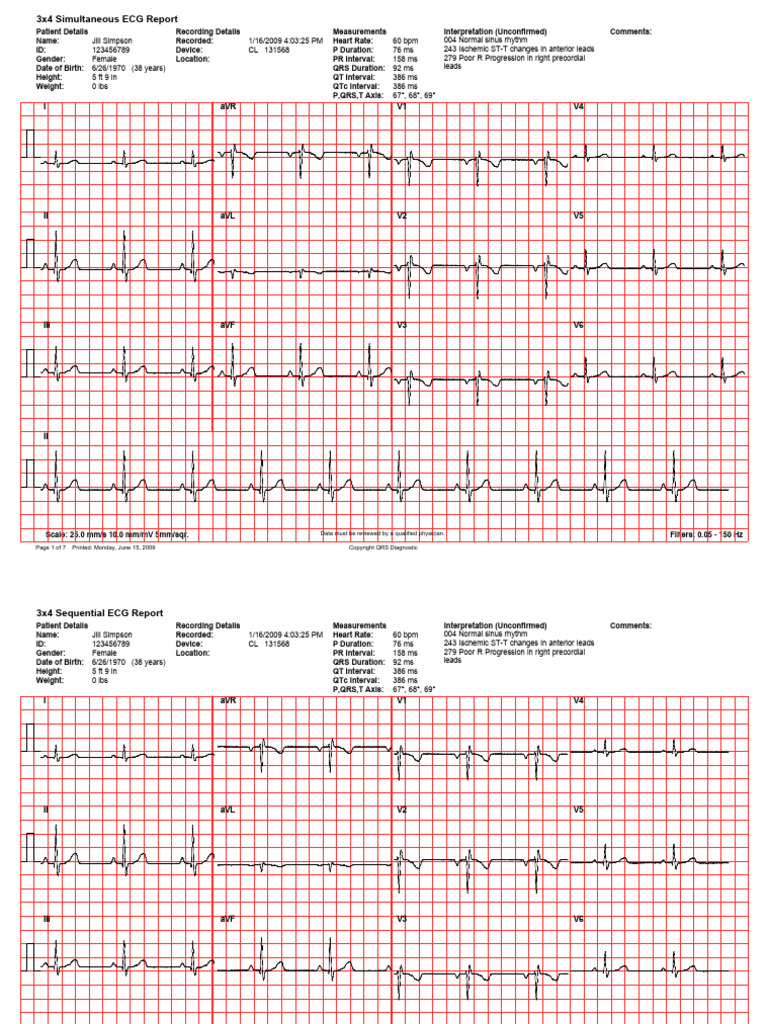 3x4 ECG Report for Jill Simpson | PDF | Electrocardiography | Visual Cortex