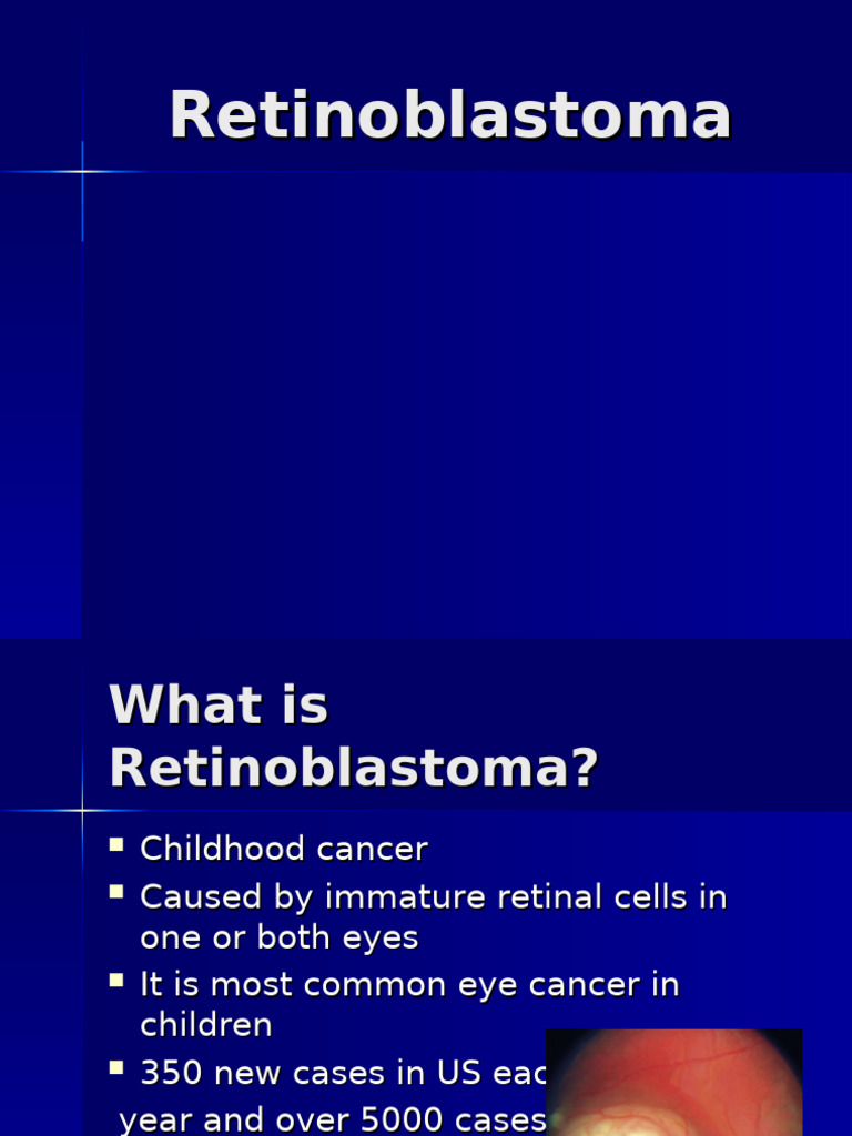 retinoblastoma | PDF