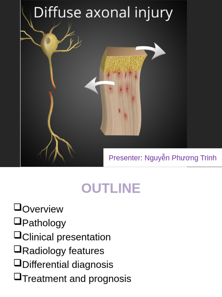 Diffuse Axonal Injury (DAI) | PDF | Traumatic Brain Injury | White Matter
