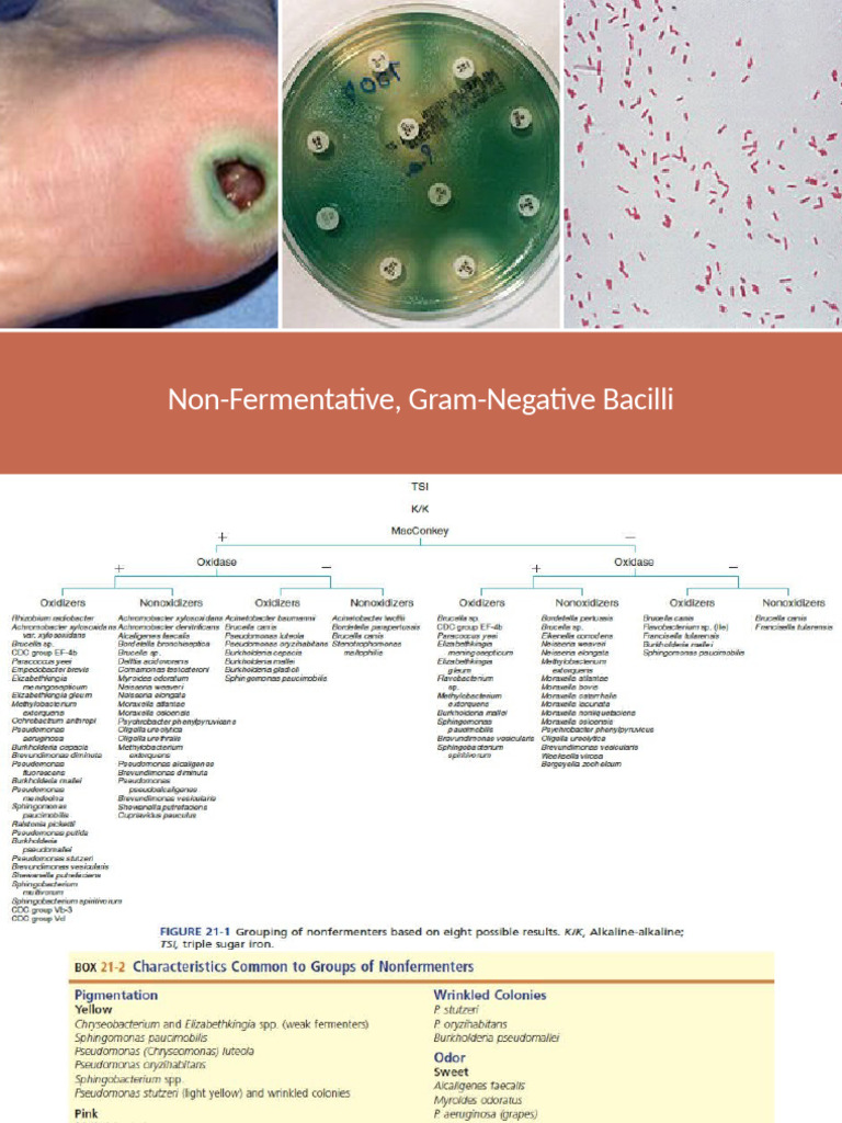 Non-Fermentative Gram-Negative Bacilli Overview | PDF | Pseudomonas ...