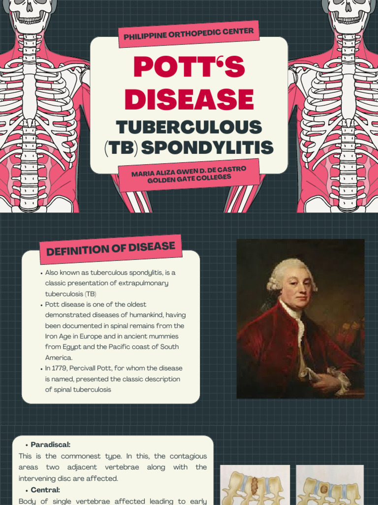 Understanding Pott's Disease: Symptoms & Treatment | PDF | Vertebra ...