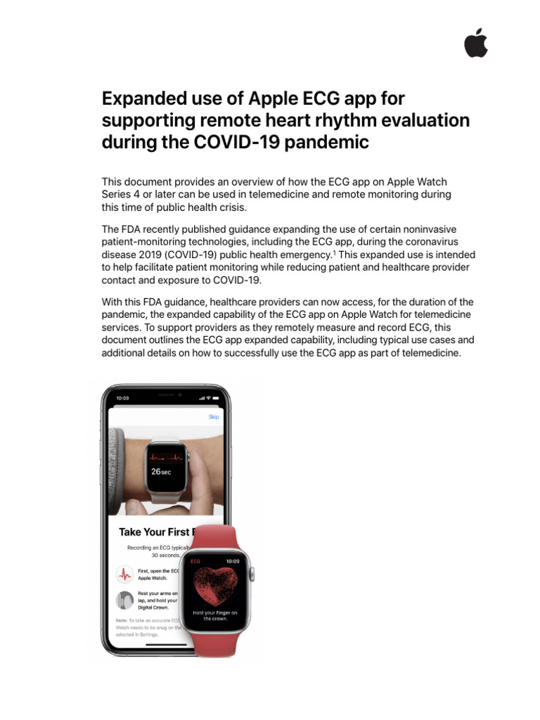 Apple ECG App During COVID-19 | PDF | Electrocardiography | Monitoring ...