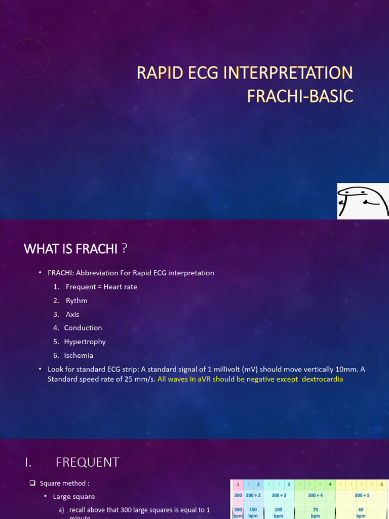 Rapid ECG Interpretation: FRACHI Method | PDF | Electrocardiography ...