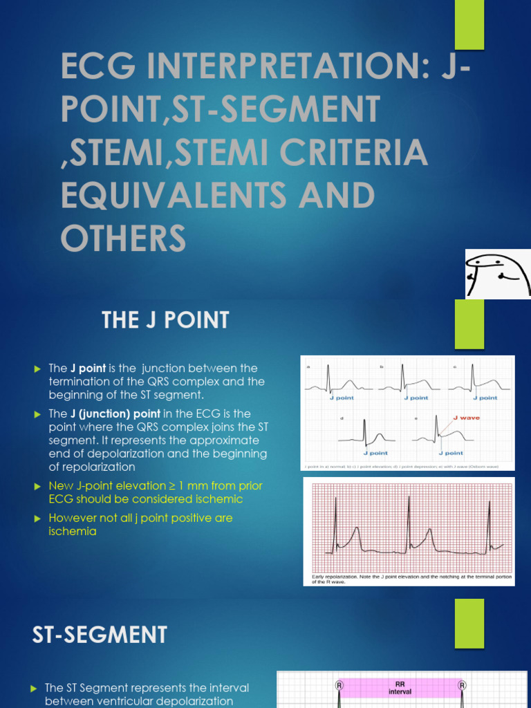 Ecg Interpretation J Point Stemi Criteria Equivalents and Others | PDF | Electrocardiography ...