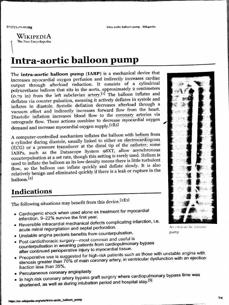 Intra - Aortic Balloon Pump 04-Apr-2025 13-02-45 | PDF