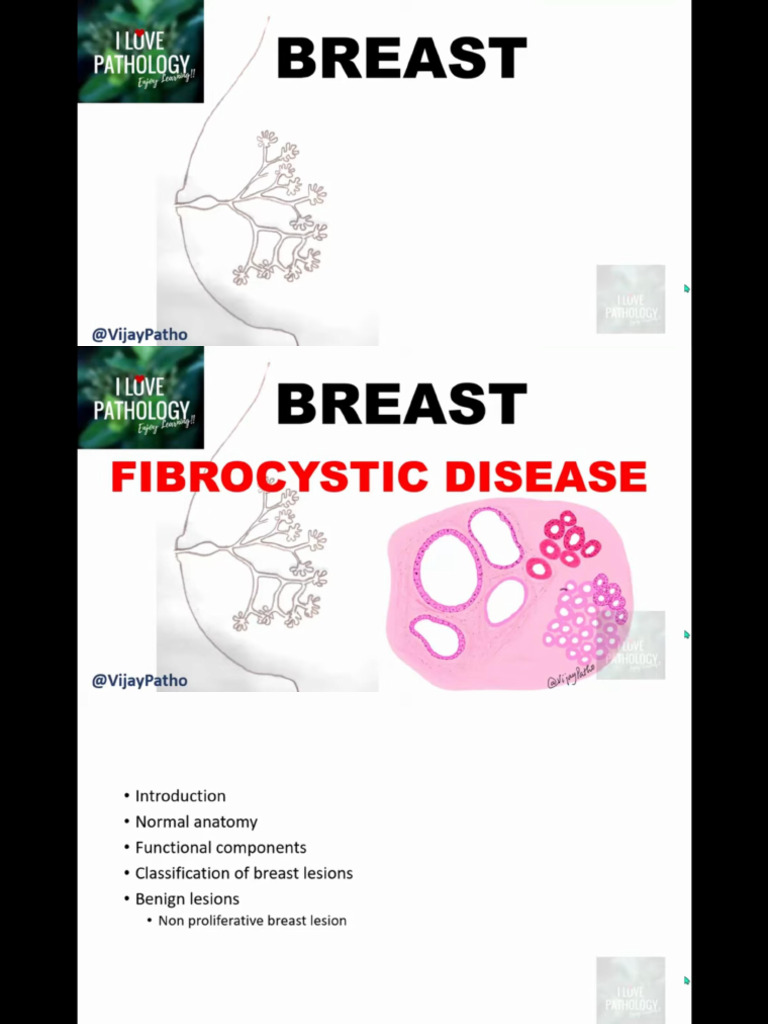 Breast Pathology | PDF