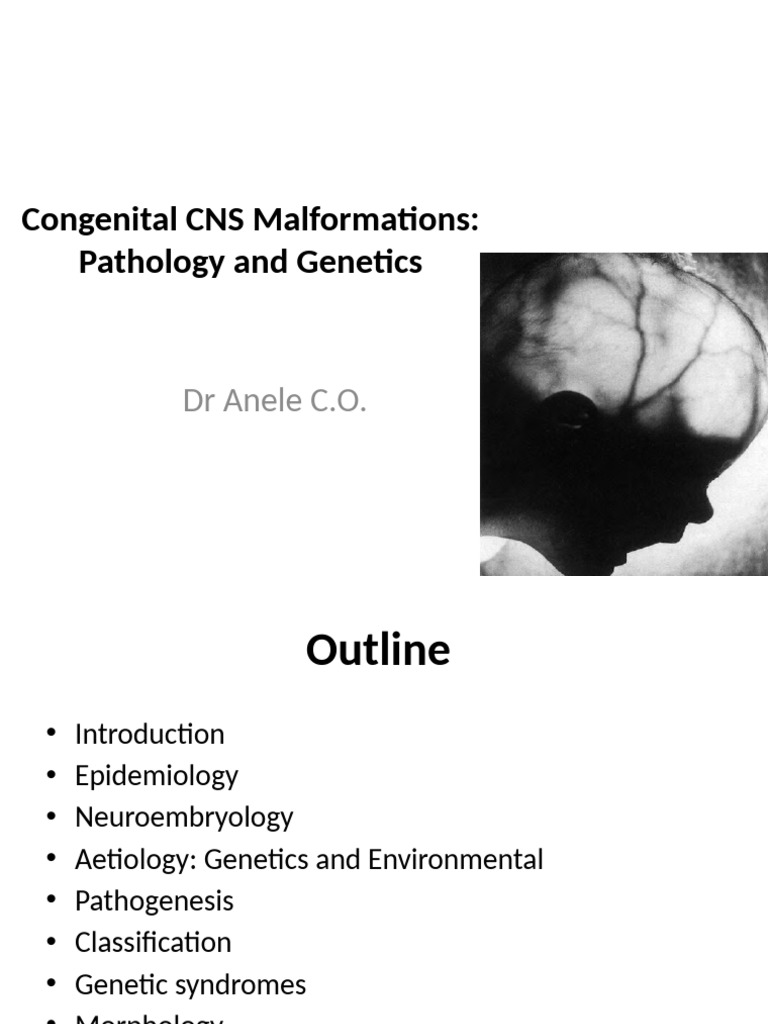 Congenital CNS Malformations | PDF | Diseases And Disorders ...