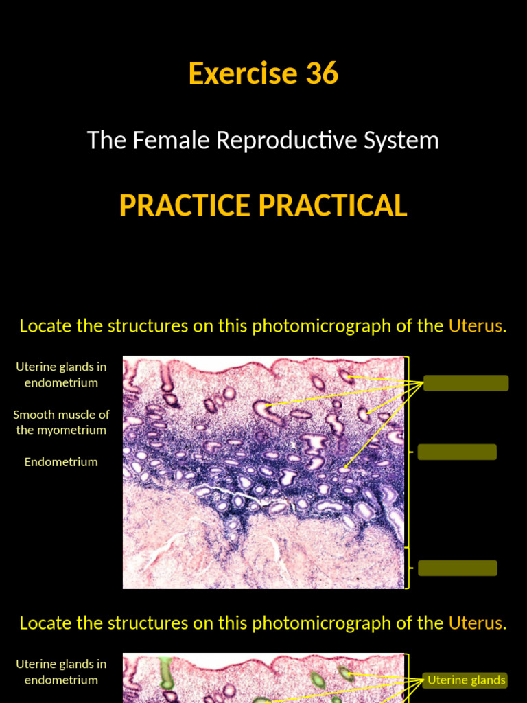 Anatomy lab Exercise 36 Practice Practical | PDF | Uterus | Vagina