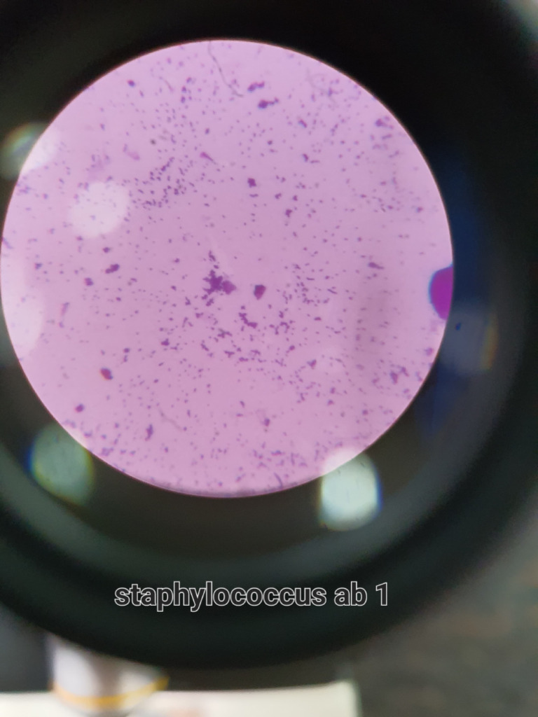 Microbiology Spotters 3rd Internals Pdf Agar Filtration