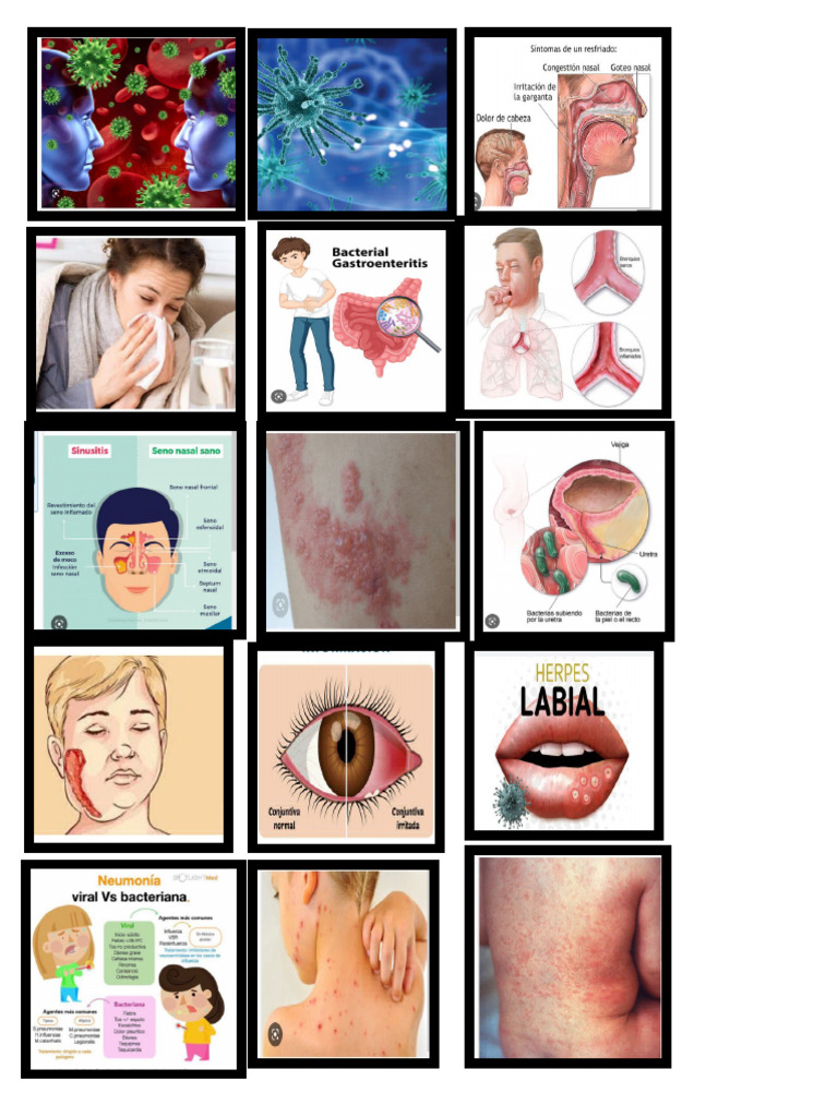 Enfermedades Virales | PDF