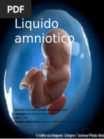Líquido Amniótico Meconial: Evidencias 2018 | PDF | Parto | El embarazo
