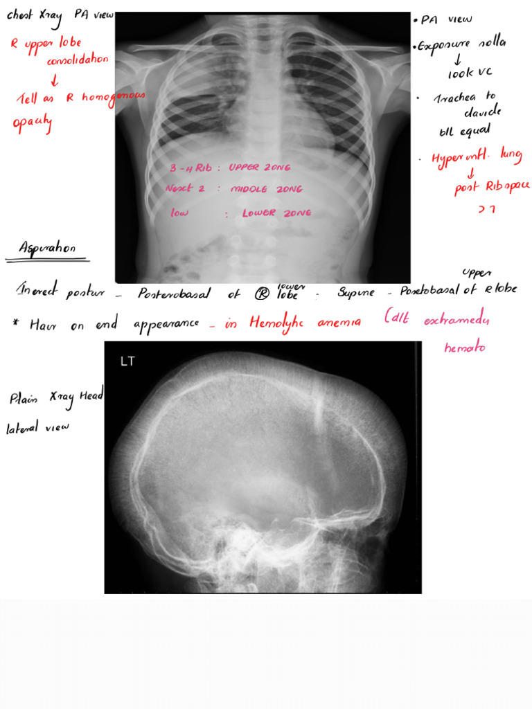 PEDIA X RAY _250125_084055 | PDF