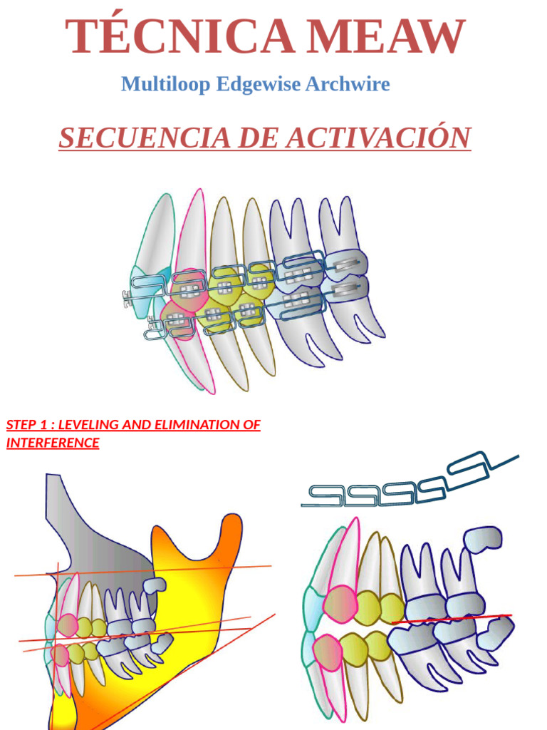 Secuencia de Arcos Meaw | PDF