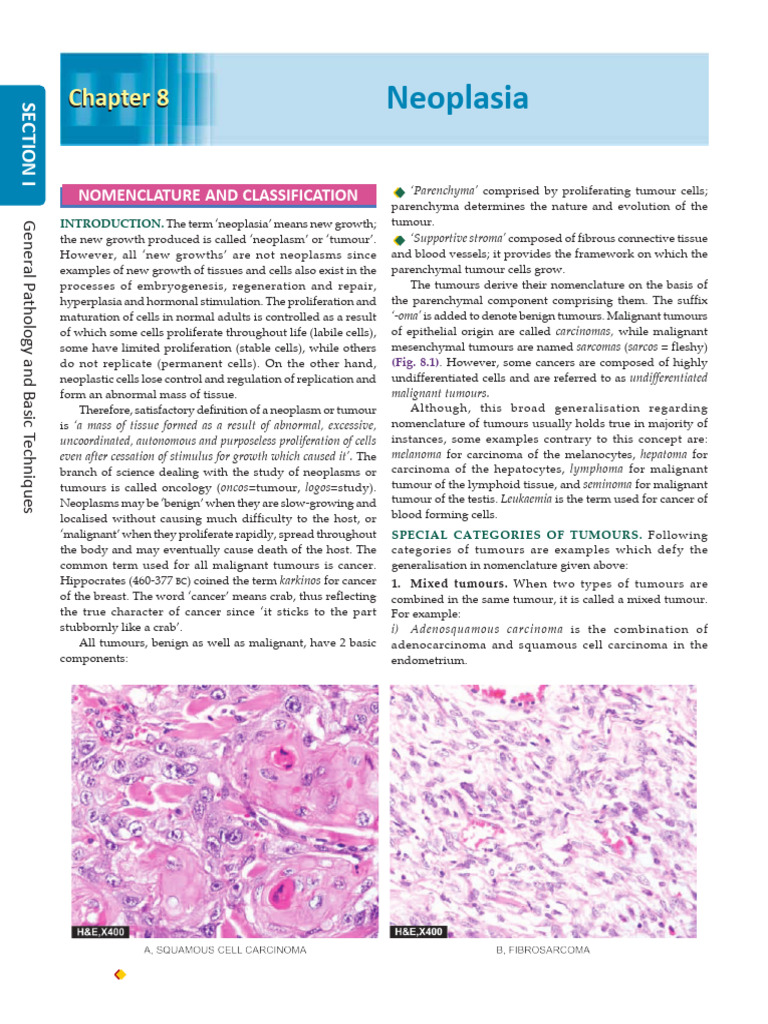 Neoplasm | PDF | Neoplasms | Epithelium