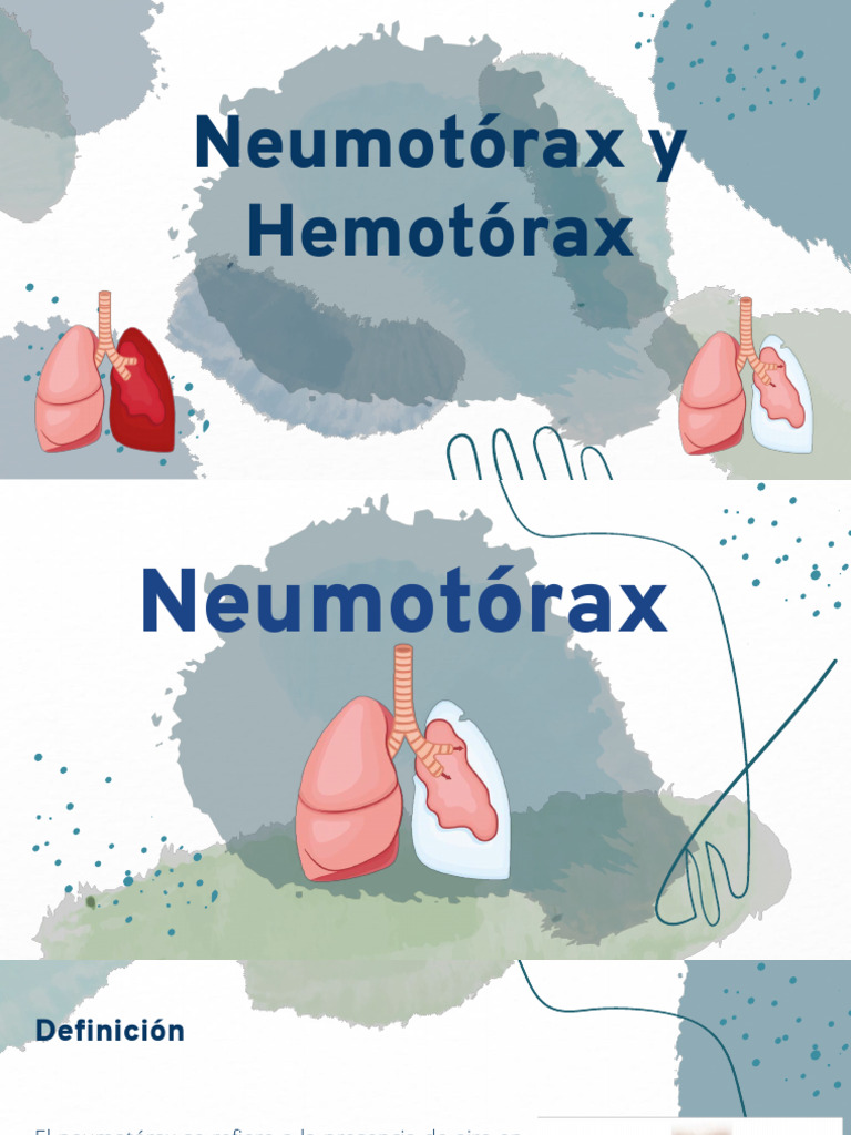 Neumotórax y Hemotórax: Definición y Manejo | PDF | Especialidades ...