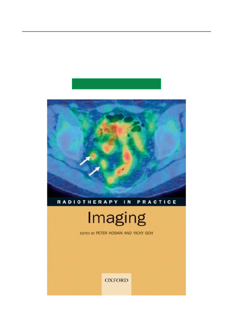Most Wanted Radiotherapy in Practice Imaging, 1st Edition Complete Book Download | PDF