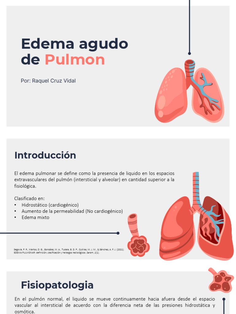 Edema Pulmonar: Definición y Tratamiento | PDF | Edema | Pulmón