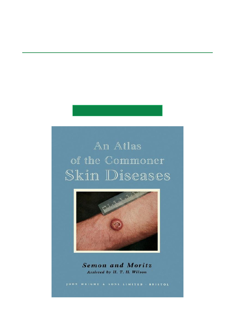An Atlas of The Commoner Skin Diseases With 153 Plates Reproduced by ...