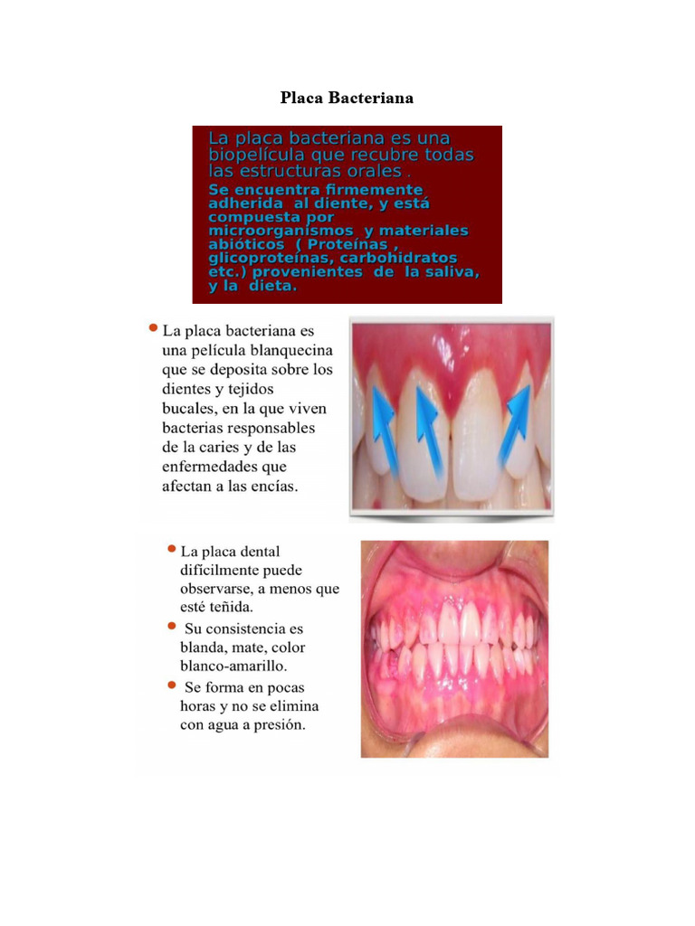 placa bacteriana | PDF