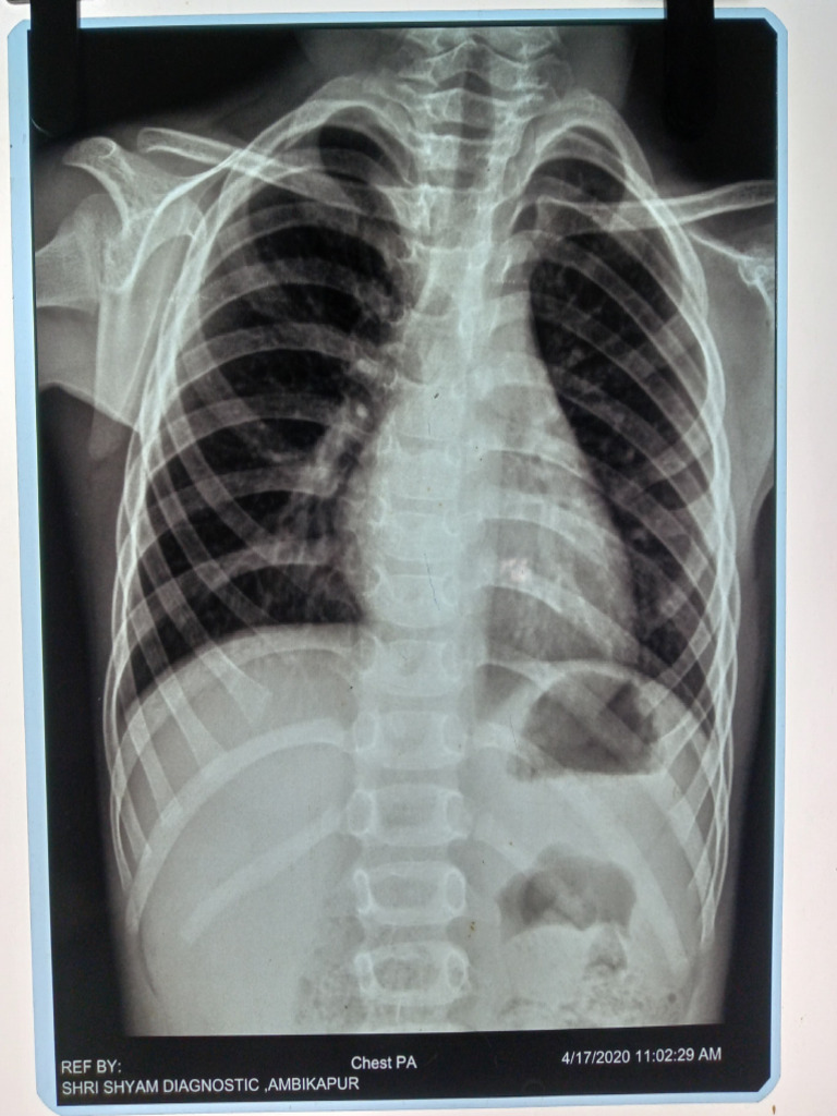 Xray 30 November | PDF