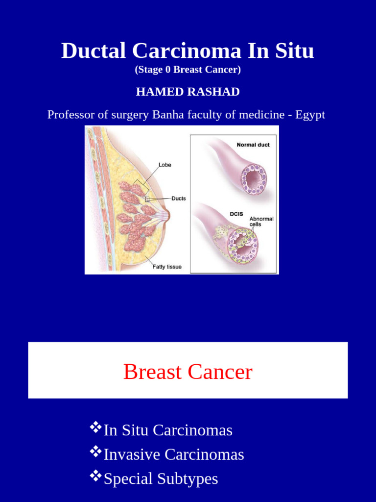 Breast CA in Situ The Lect | PDF | Mastectomy | Mammography