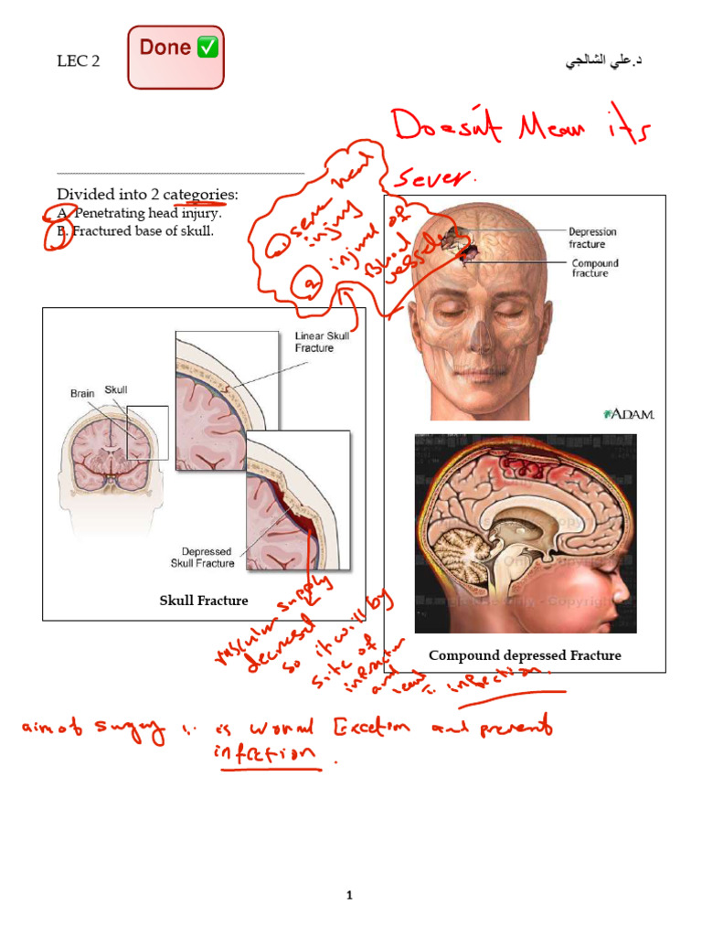 7 Complicated Head Injury (Handout) | PDF | Cerebrospinal Fluid ...