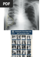 Scottie Dog Sign (Spine) Radiology Reference Article | PDF | Vertebral ...