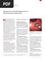Lid Parallel Conjunctival Folds (LIPCOF) | PDF | Optics | Ophthalmology