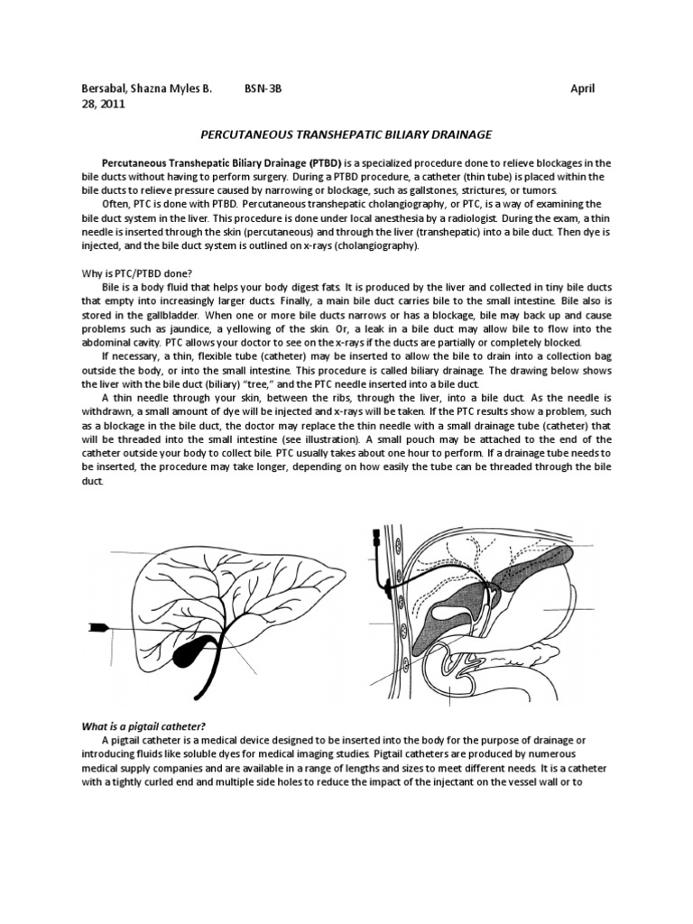 Per Cutaneous Trans Hepatic Biliary Drainage | Bile | Medical Specialties