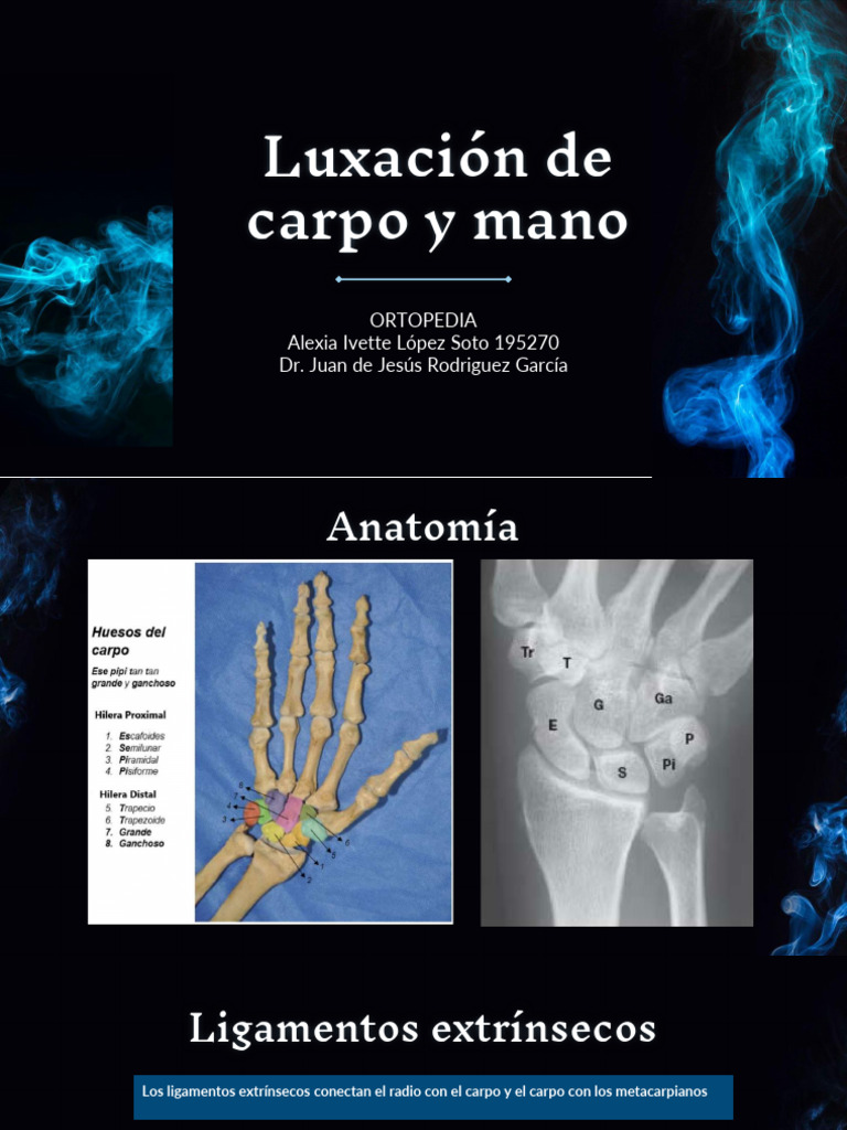 Luxación del Carpo: Diagnóstico y Tratamiento | PDF | Mano | Sistema ...