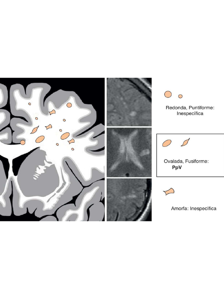 Puntiforme | PDF