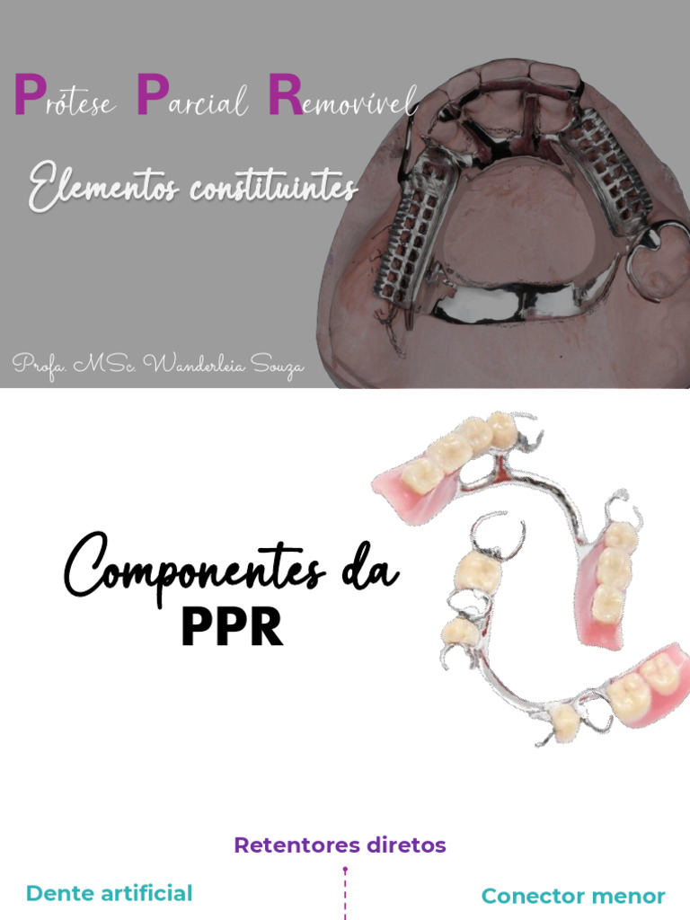 Grampos e Elementos Constituintes Da PPR | PDF | Dente humano ...