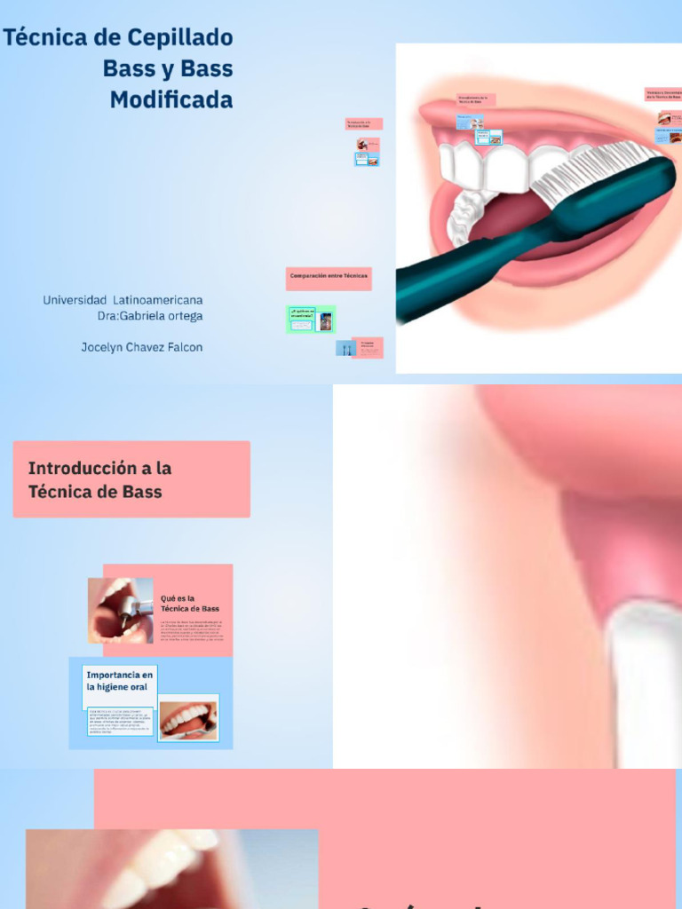Tecnica de Bass y Bass Modificada JCF | PDF