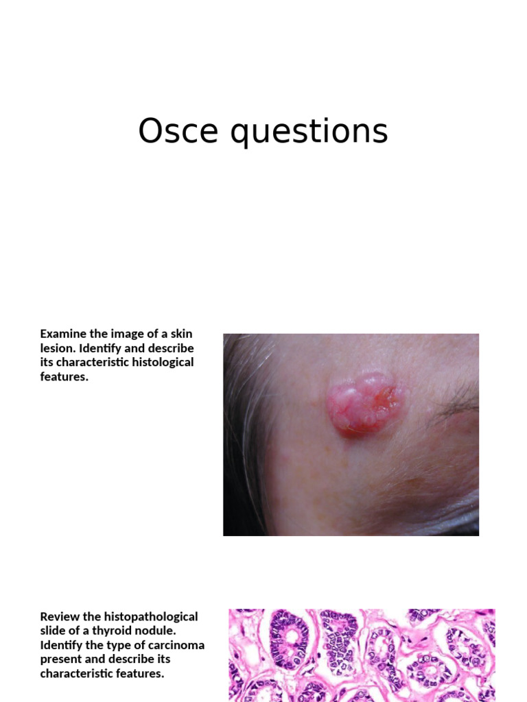osce questions surgery 2024 | PDF