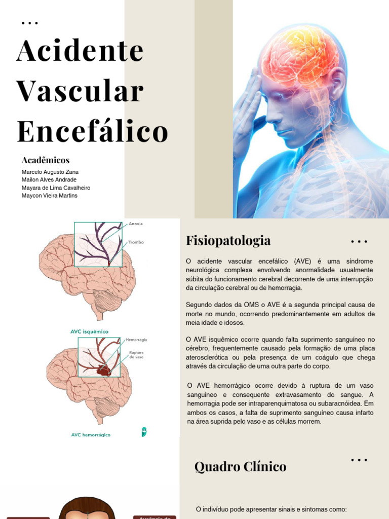 Acidente Vascular Encefálico 20250520 195226 0000 | PDF | Músculo | AVC