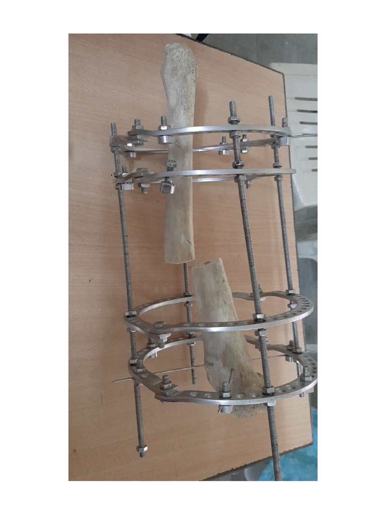 Ortho Instruments | PDF
