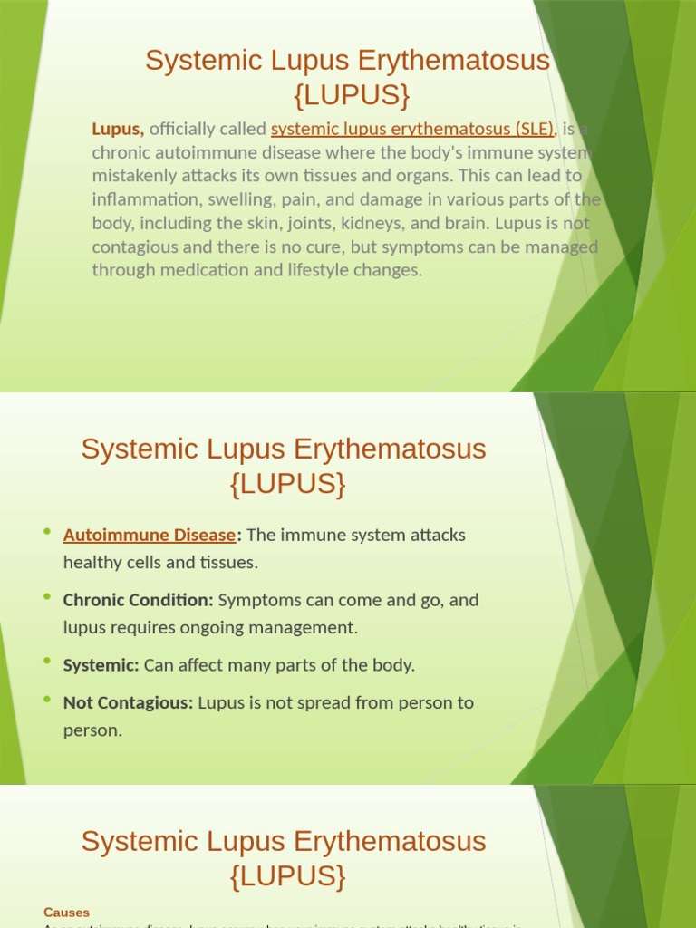 Understanding Systemic Lupus Erythematosus | PDF | Autoimmune Disease ...