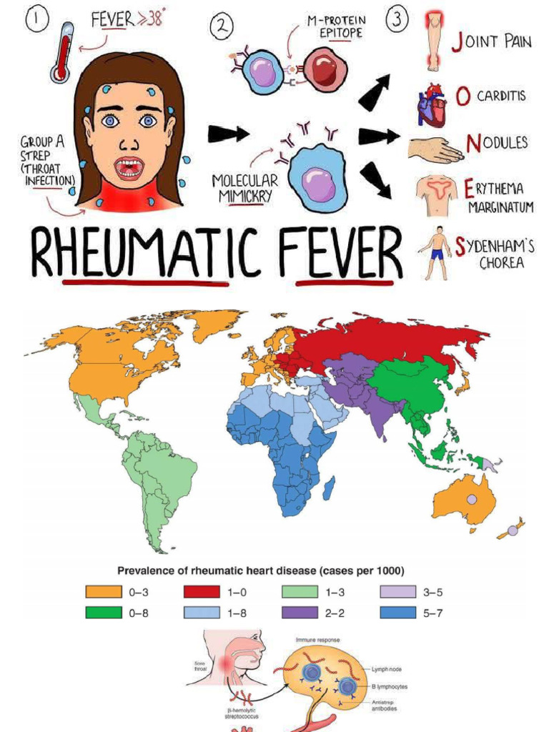 Acute Rheumatic Fever | PDF