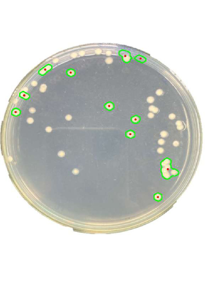 Placa Contagem Final | PDF