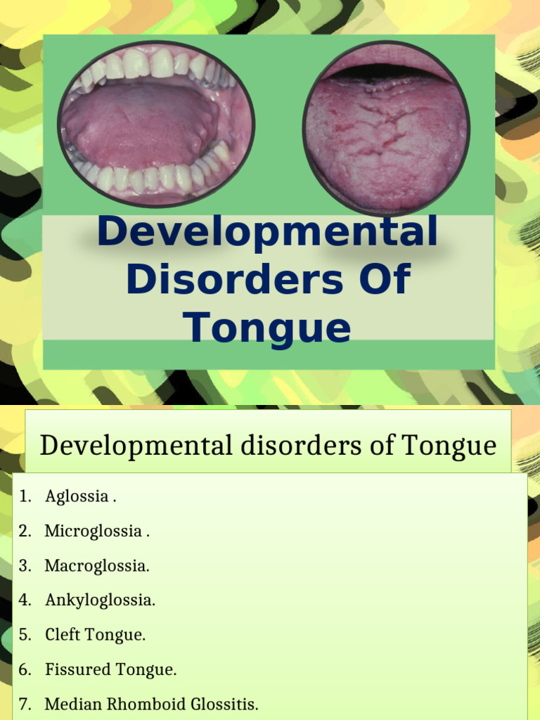 Tongue Disorder DR, Ruth | PDF | Tongue | Human Diseases And Disorders