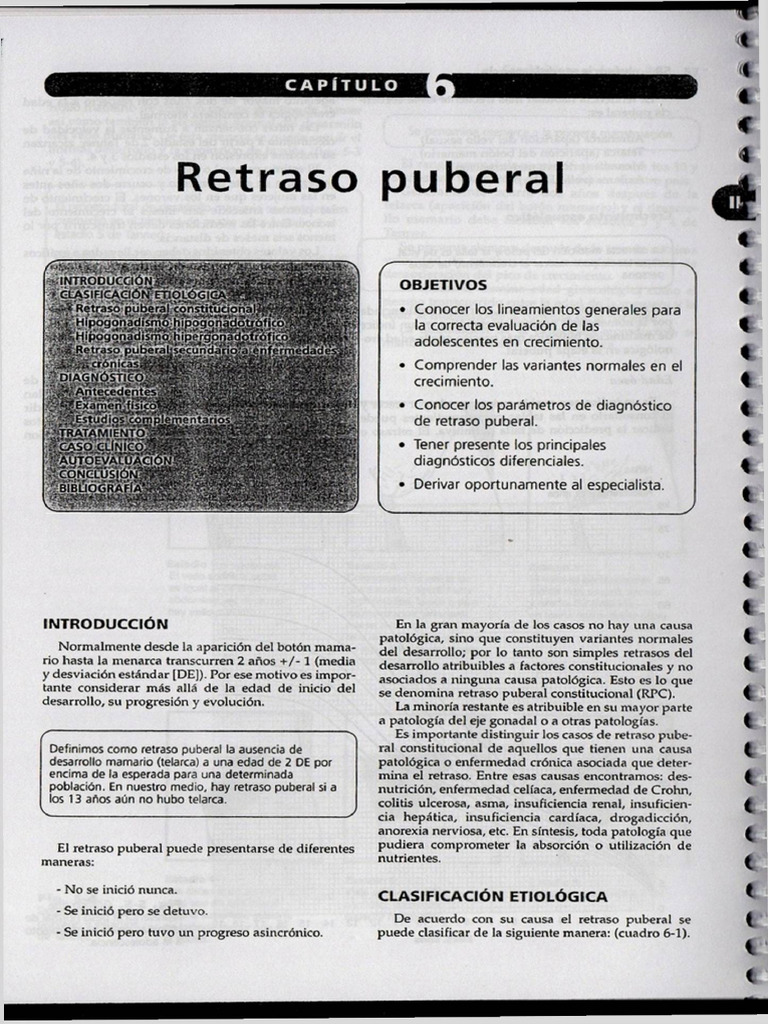 Retraso Puberal Femenino | PDF