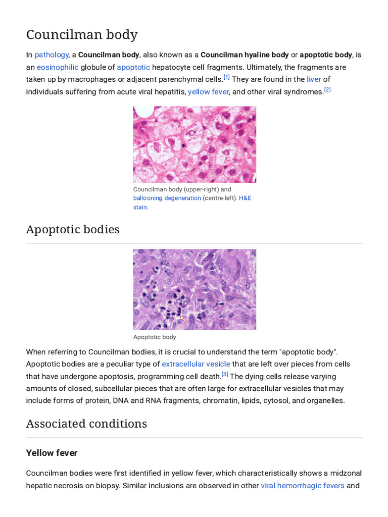 Councilman body in human biology - Wikipedia | PDF | Apoptosis | Liver