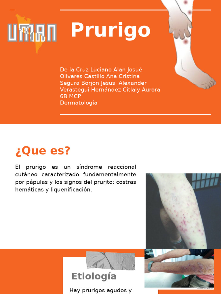 PRURIGO | PDF | Inmunología | Medicina