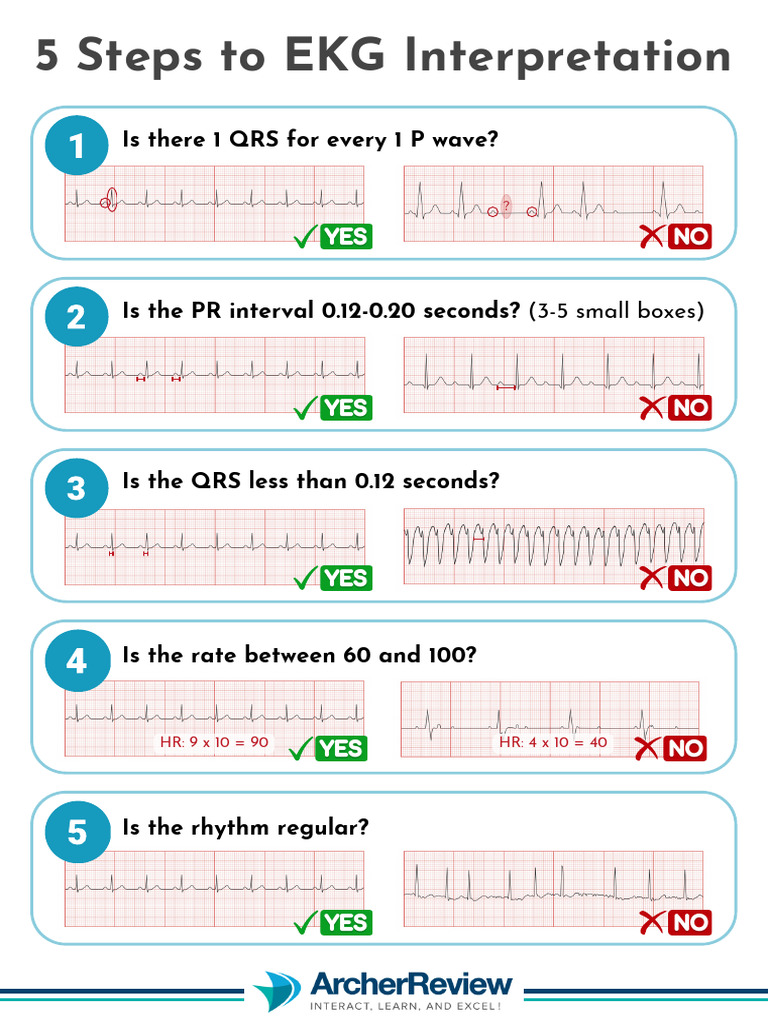 Steps To EKG | PDF