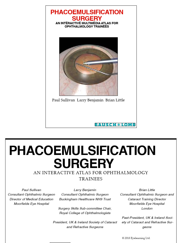Phacoemulsification Surgery Paul Sullivan | PDF | Pump | Ophthalmology