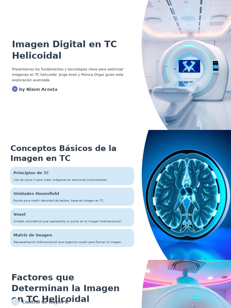 Imagen Digital en TC Helicoidal | PDF | Ct Scan