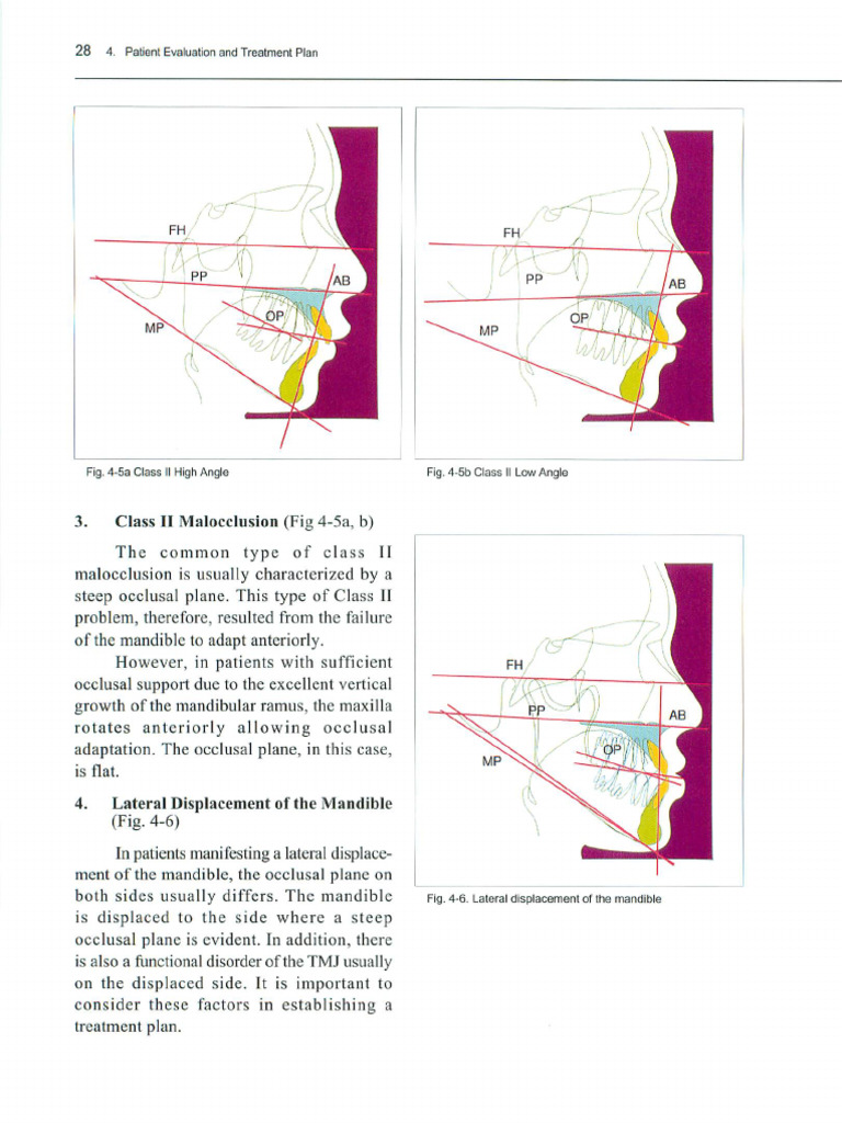 Manual For The Clinical Application of MEAW Technique-Trang-6 | PDF