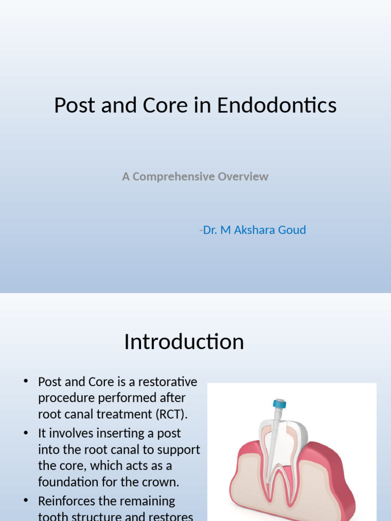 Post and Core in Endodontics | PDF | Materials | Dentistry Branches