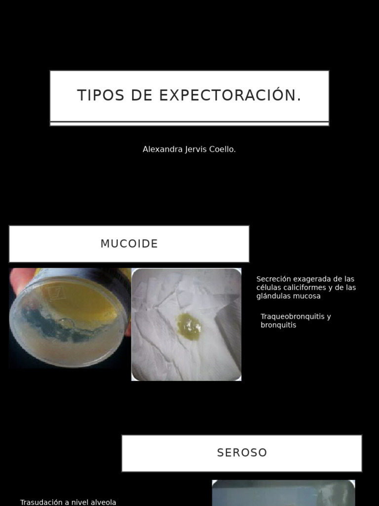 Tipos de Expectoración | PDF